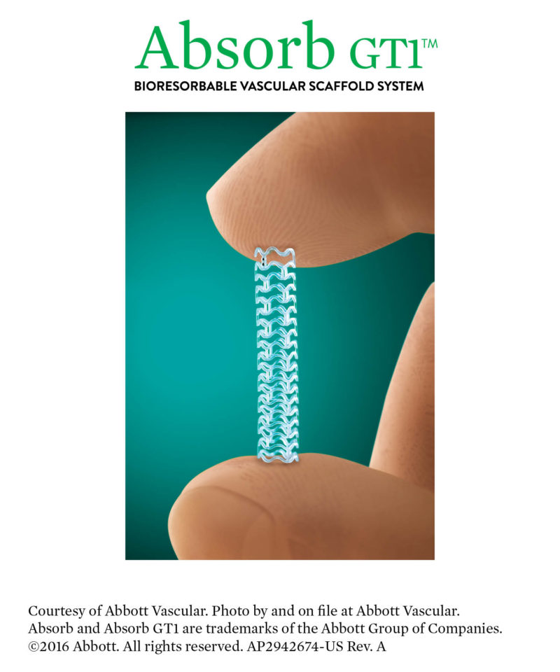 The Arrival of the Organic Stent